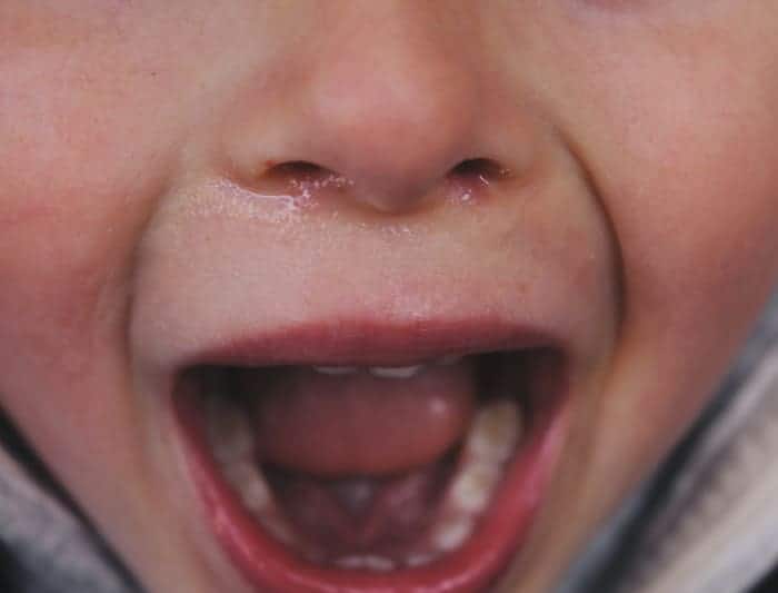 Set Your Child’s Best Life, and Find the Most Reliable Pediatric Cleft ...